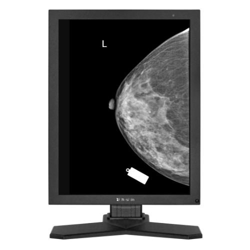 5MP Diagnostic Monitor for Mammography | Medical Display Manufacturer ...