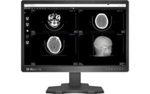 Medical Imaging Standards for Diagnostic Displays
