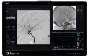 Best Displays for Digital Pathology Review in 2025