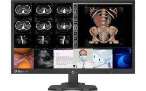 Medical Imaging Standards for Diagnostic Displays